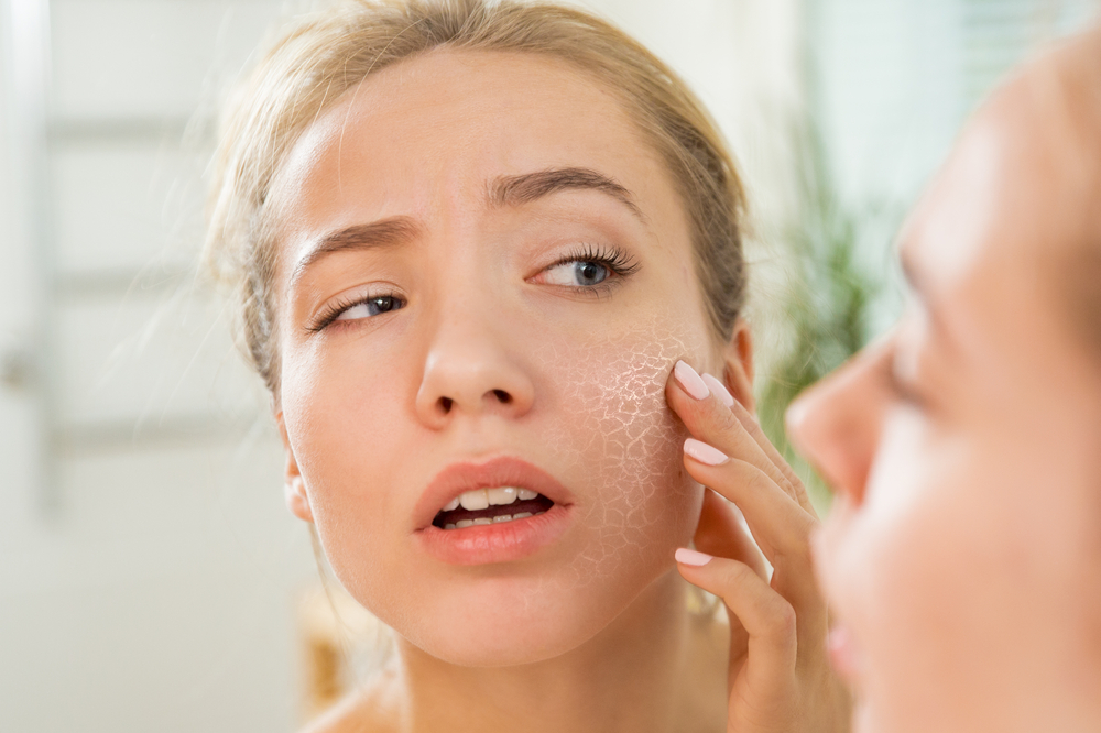 5 Reasons Why Your Skin Is Always Dry Essence Vale 5 Reasons Why Your Skin Is Always Dry Essence Vale